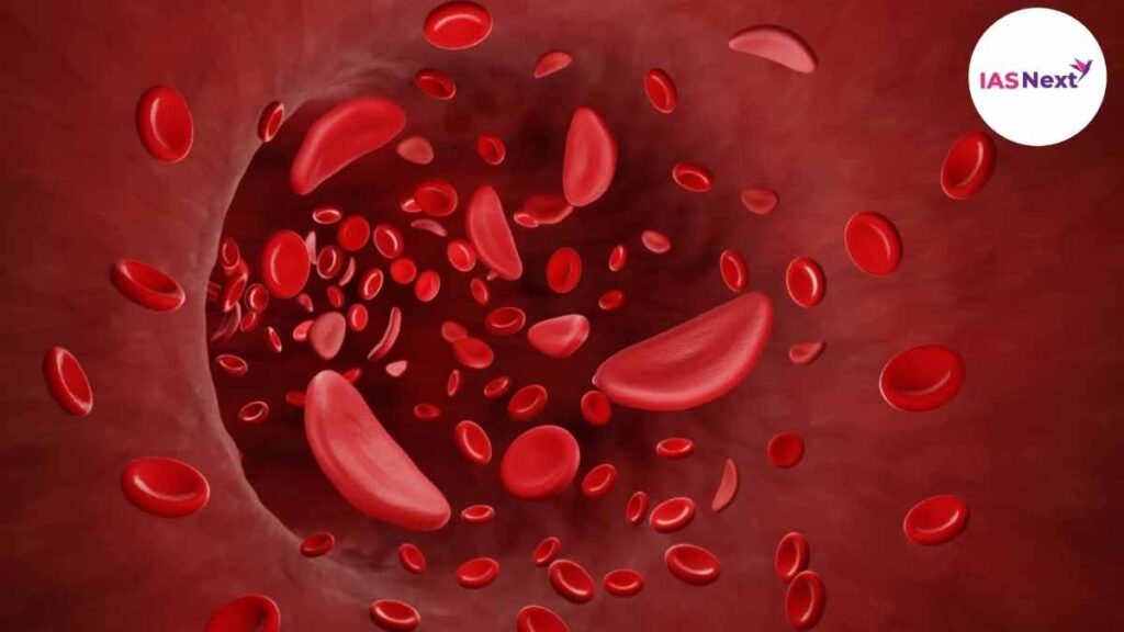 National Sickle Cell Anaemia Elimination Mission