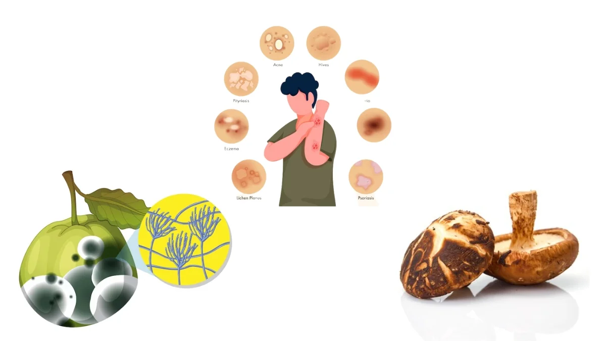 Fungal Infections Emergence: A Growing Health Concern